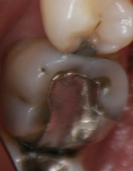 Gallery | Dentist Worthing | Cosmetic Dentist